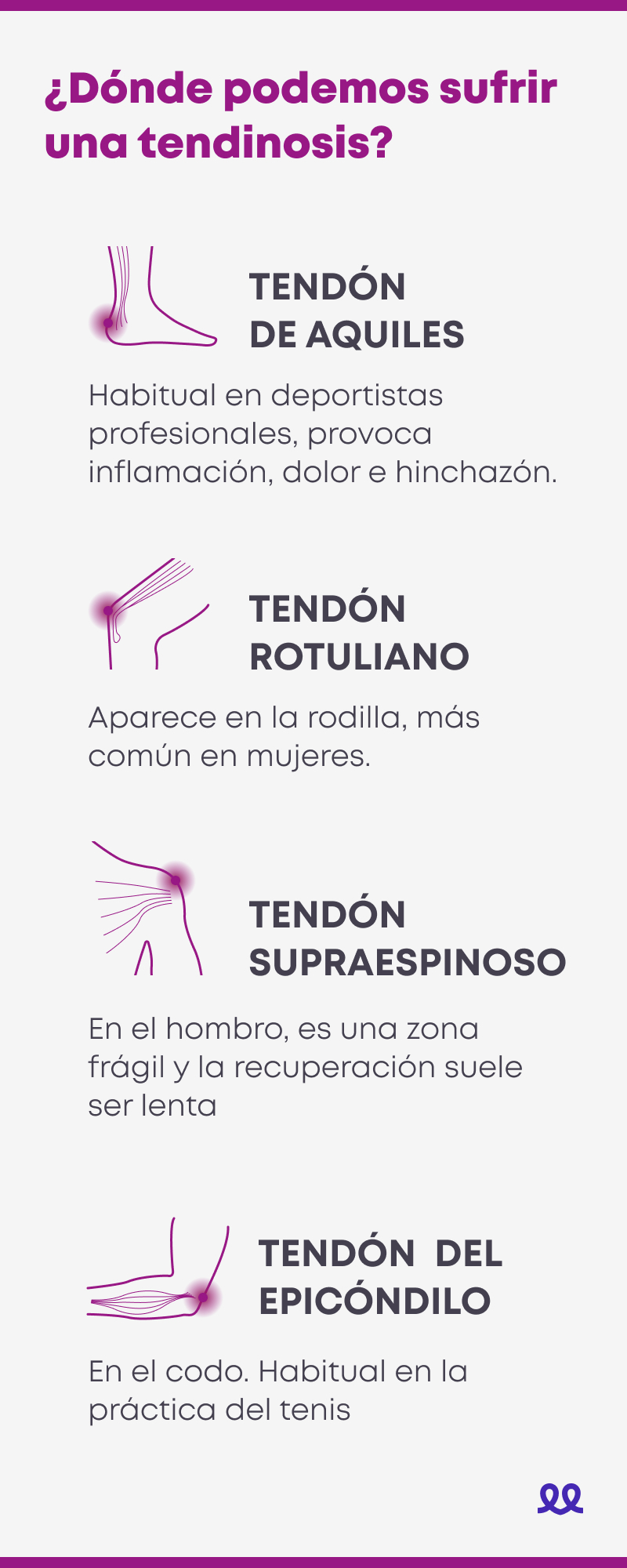 ¿Qué es la tendinosis? - Durcal Blog